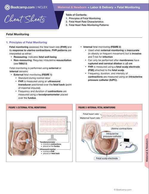 Fetal Monitoring Cheat Sheet | NCLEX® Bootcamp